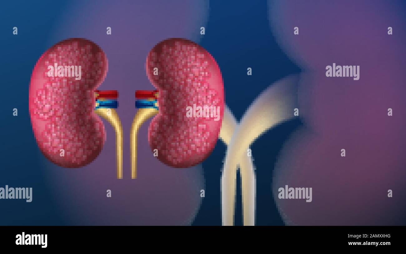 kidney disease, Human anatomy care. kidney cancer. realistic vector ...