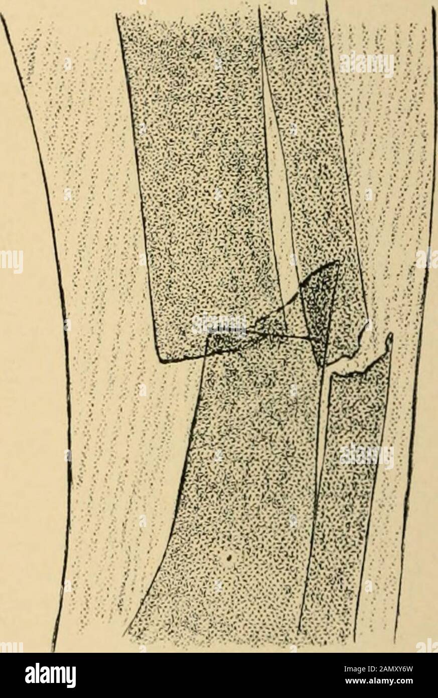 Bowing inward hi-res stock photography and images - Alamy