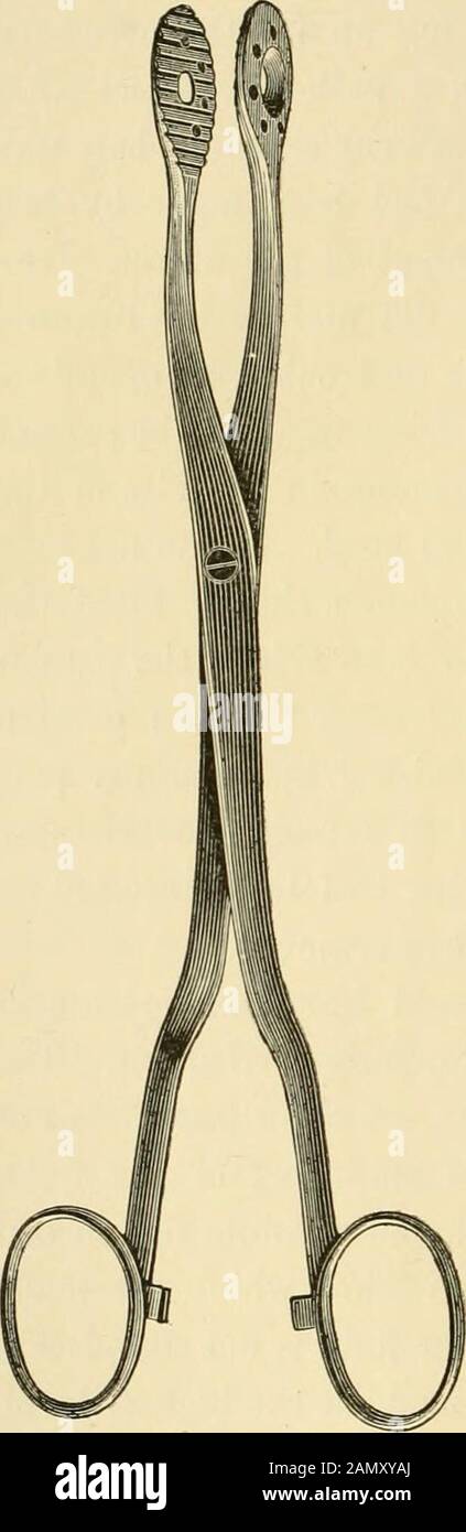 Ovarian puncture hi-res stock photography and images - Alamy