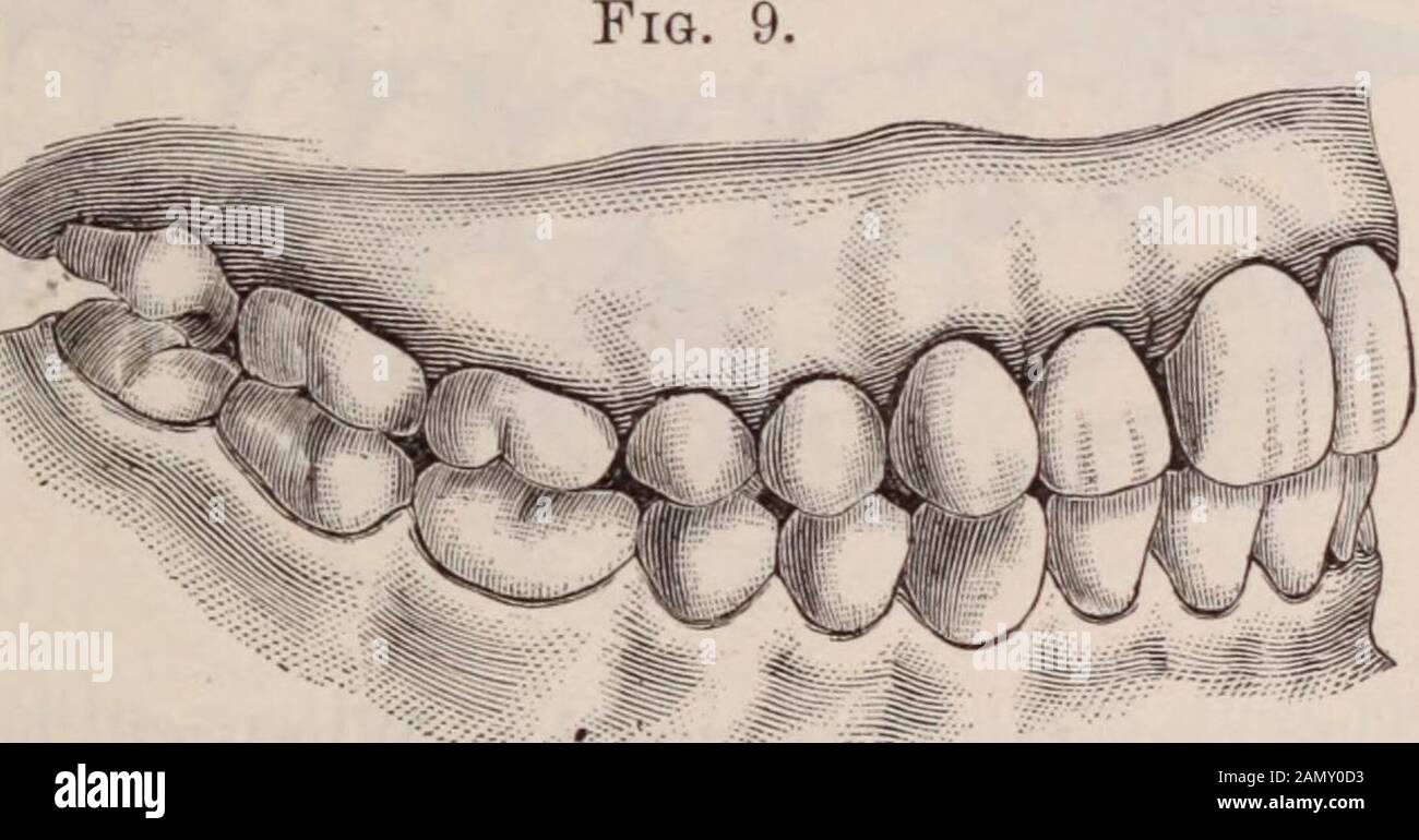 Dental cosmos . rs no longerclose beneath the upper centrals any ...