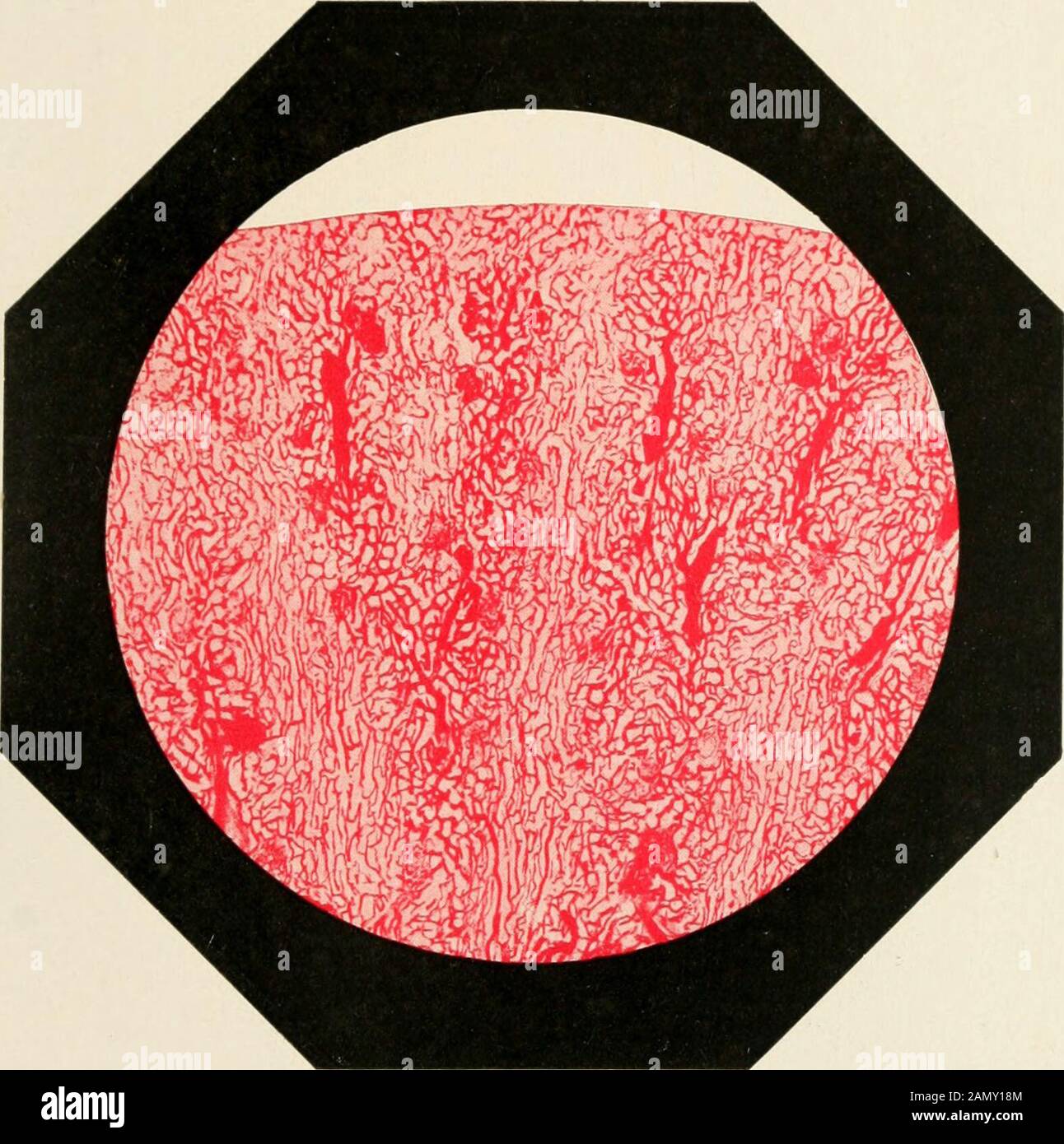 Cellules de la vessie hi-res stock photography and images - Alamy