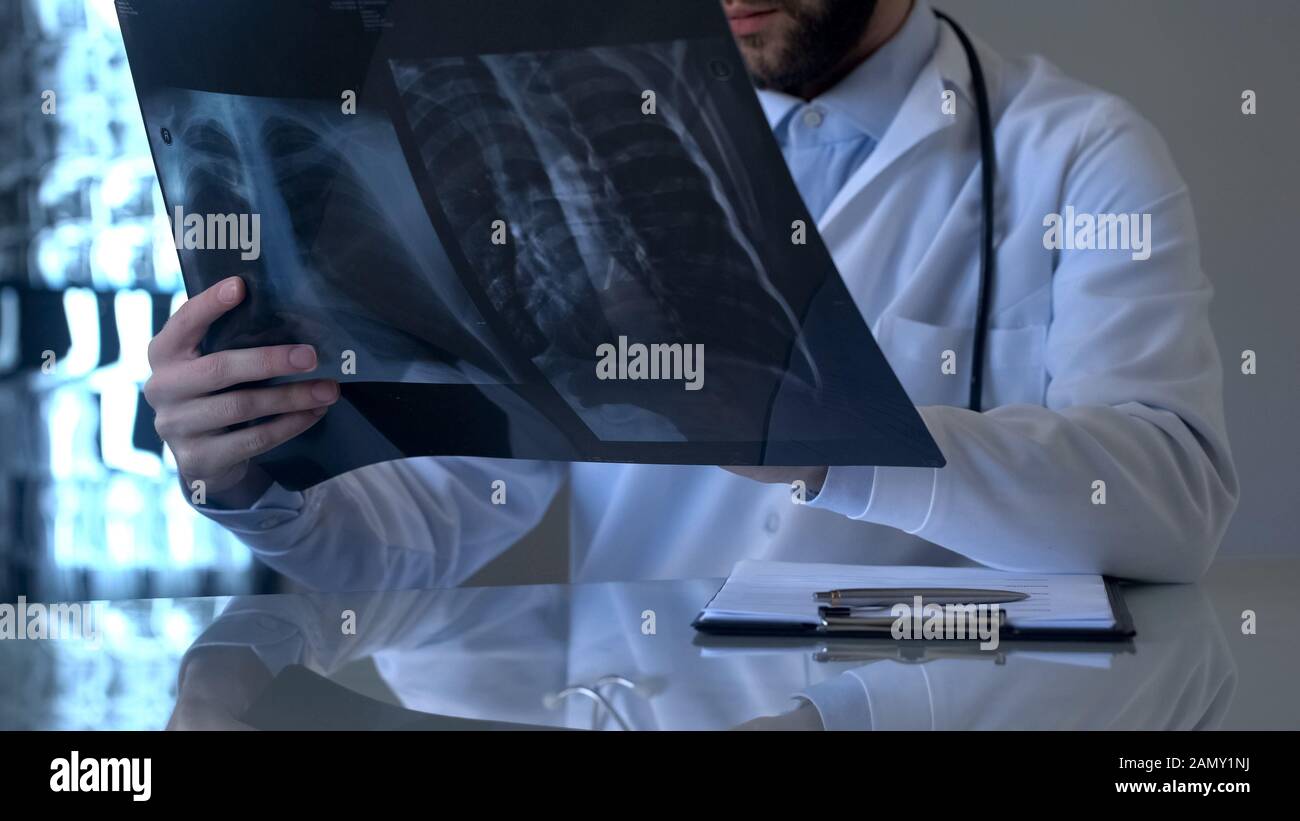 Male pulmonologist looking at lungs x-ray, observations and diagnosis ...