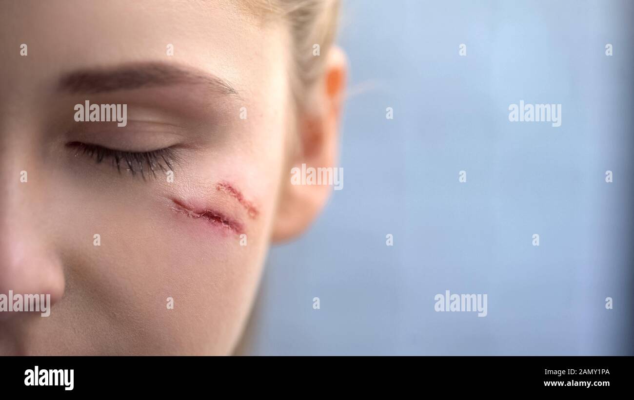 Close up of young female face with deep scars, domestic violence victim ...