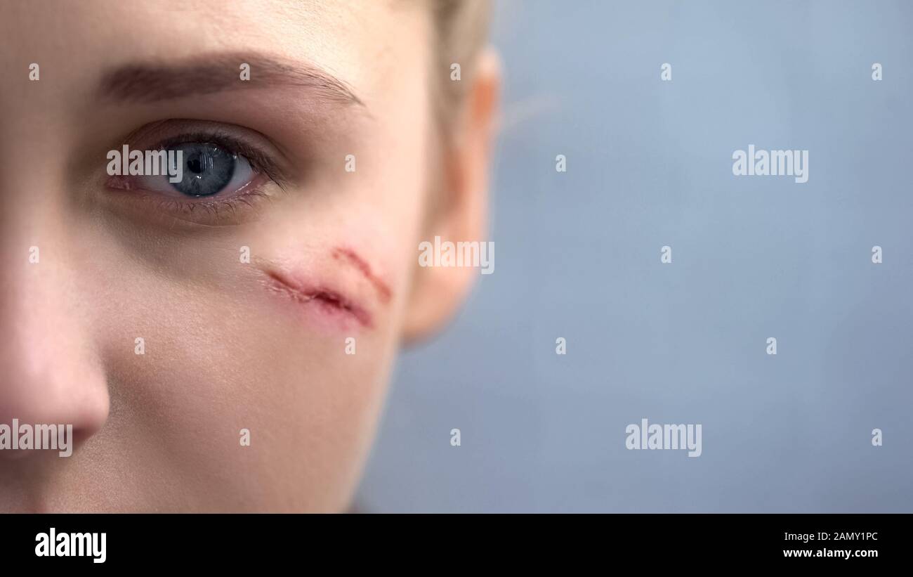 Defenseless hi-res stock photography and images - Alamy