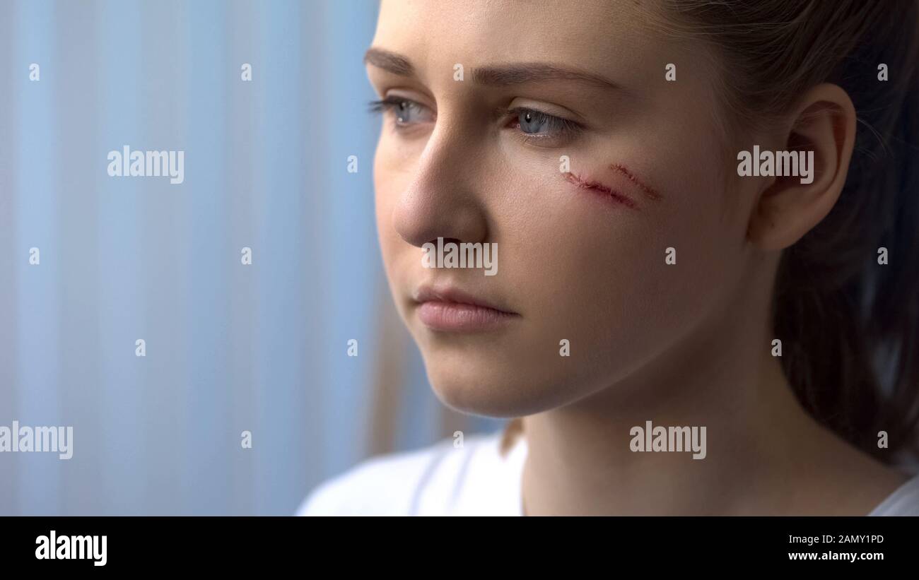 Face of young depressed woman with scars on cheek, trauma after car ...