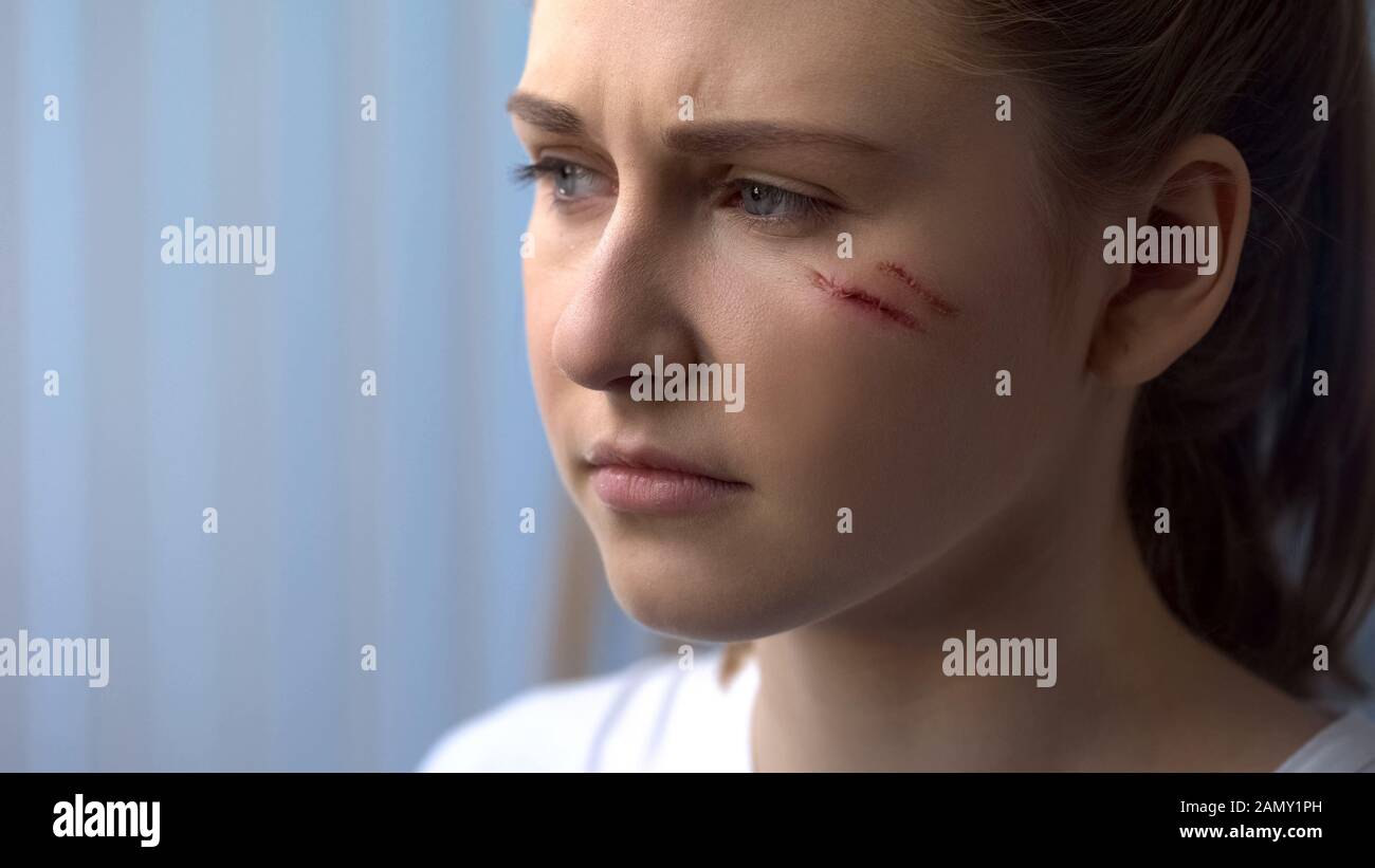 Face of upset young girl with scars on cheek, first aid after trauma ...