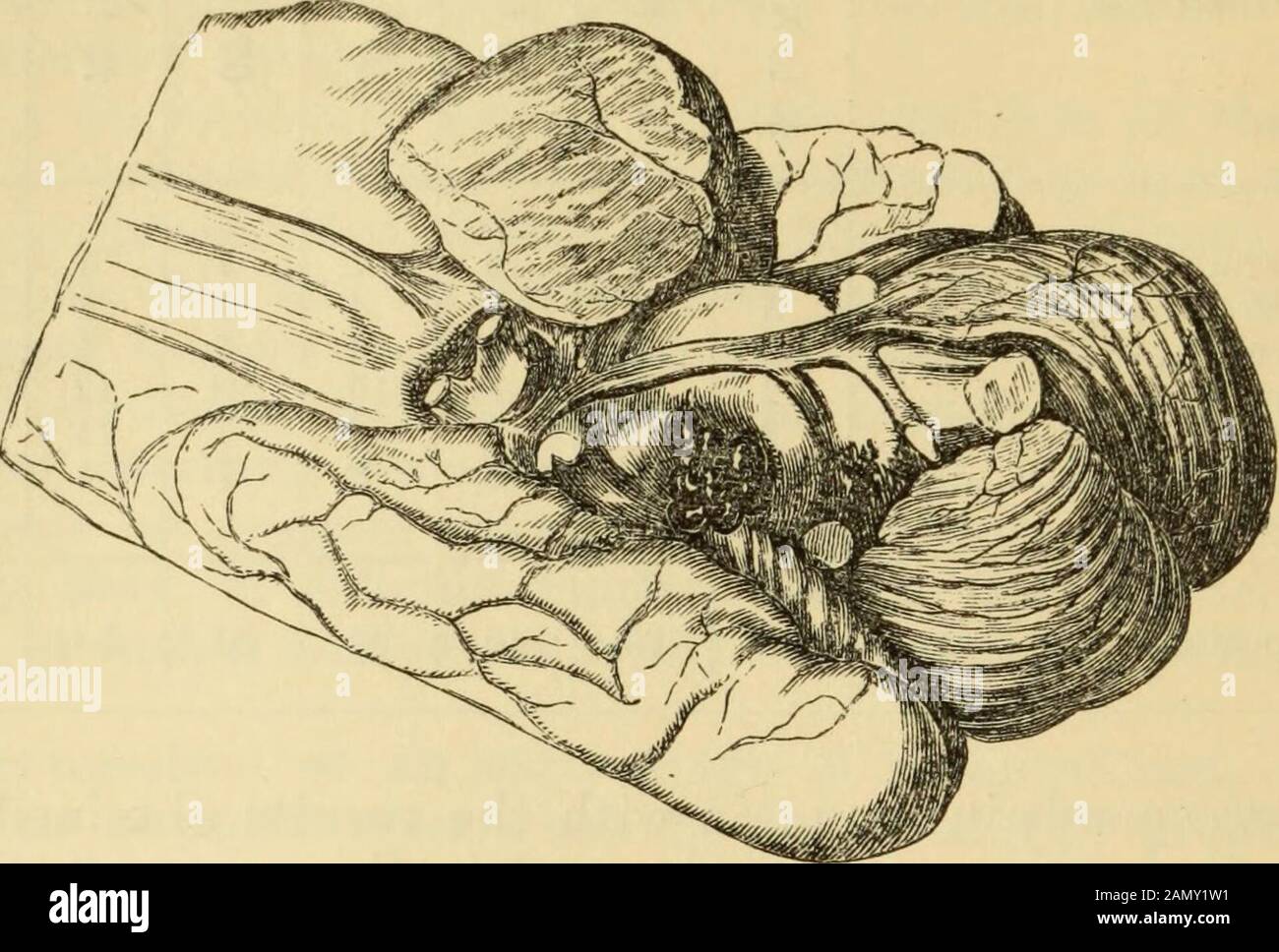 Manual of pathological anatomy . rhage.All parts of the encephalon may ...