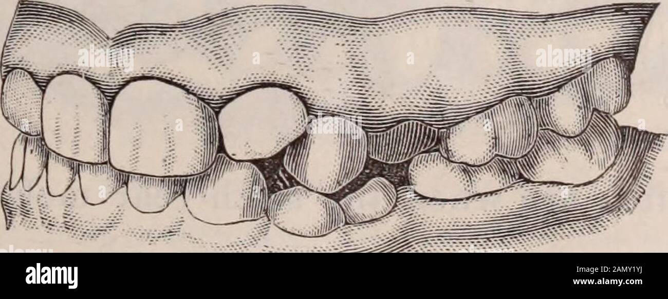 Dental cosmos . dependent we are upon the sixth-year molar to keep the ...