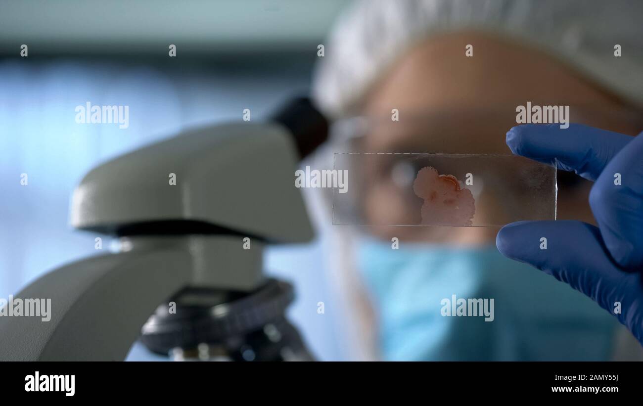 Lab assistant looking at microscope slide with blood, genetic research ...