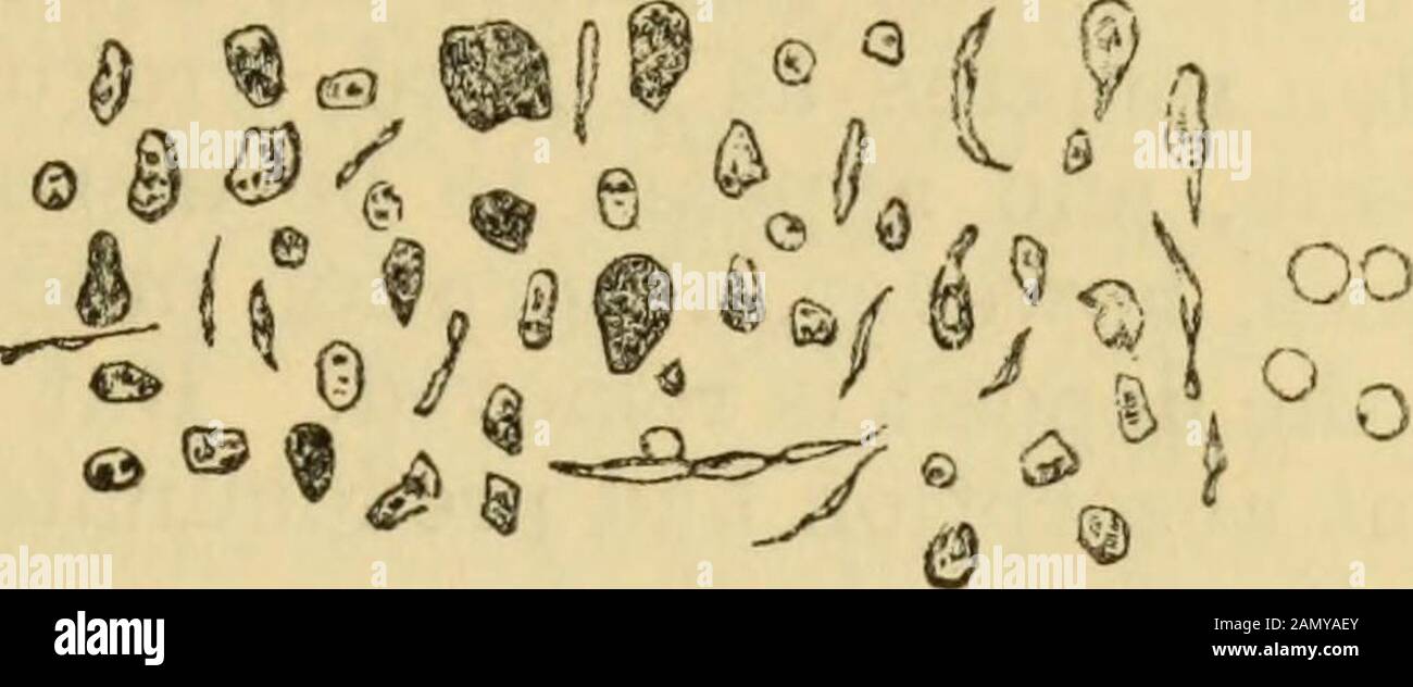 Manual of pathological anatomy . also been called scrofulous matter ...