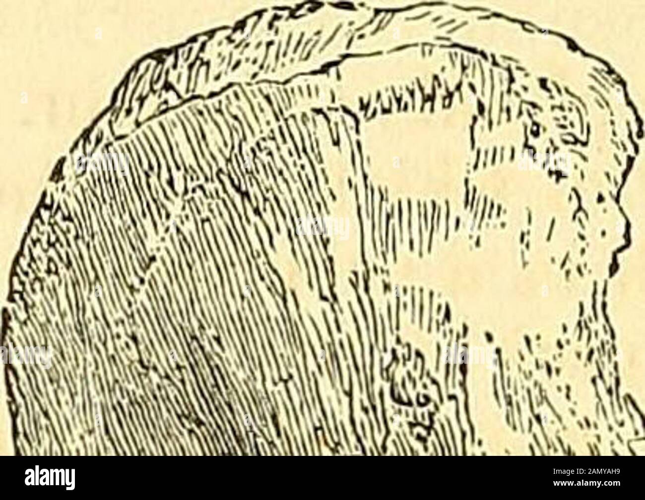A system of surgery : pathological, diagnostic, therapeutic, and ...
