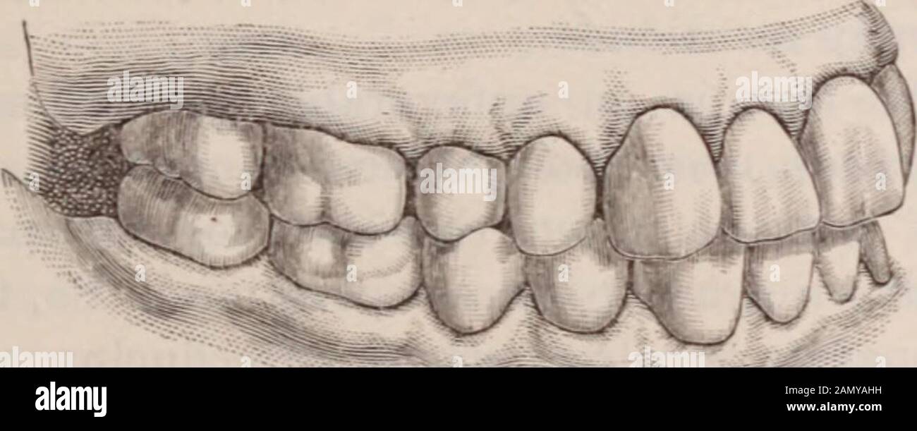 Dental cosmos . s maintainedonly by general tendency and interlocking ...