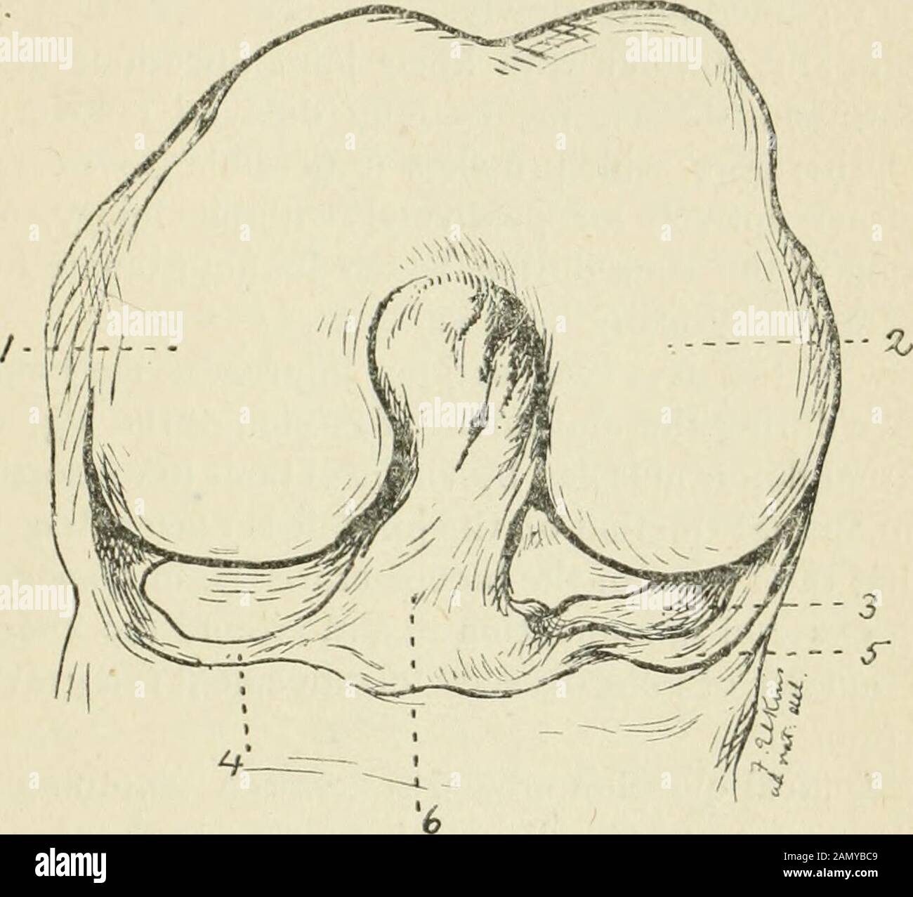 Annals of surgery . IV.—Intfrior of Knee-Joint.Inter-articular fibro ...