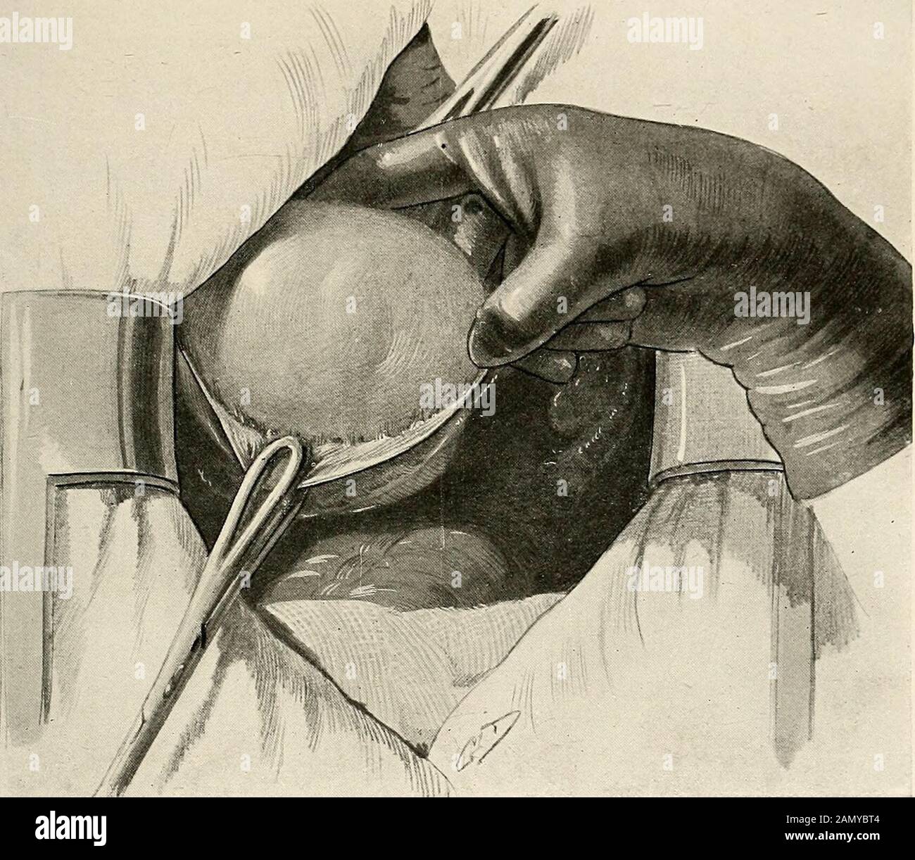 Ring Forceps High Resolution Stock Photography and Images - Alamy