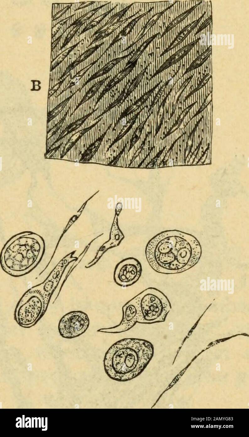 Manual of pathological anatomy . ost allspecimens of scirrhus at the ...