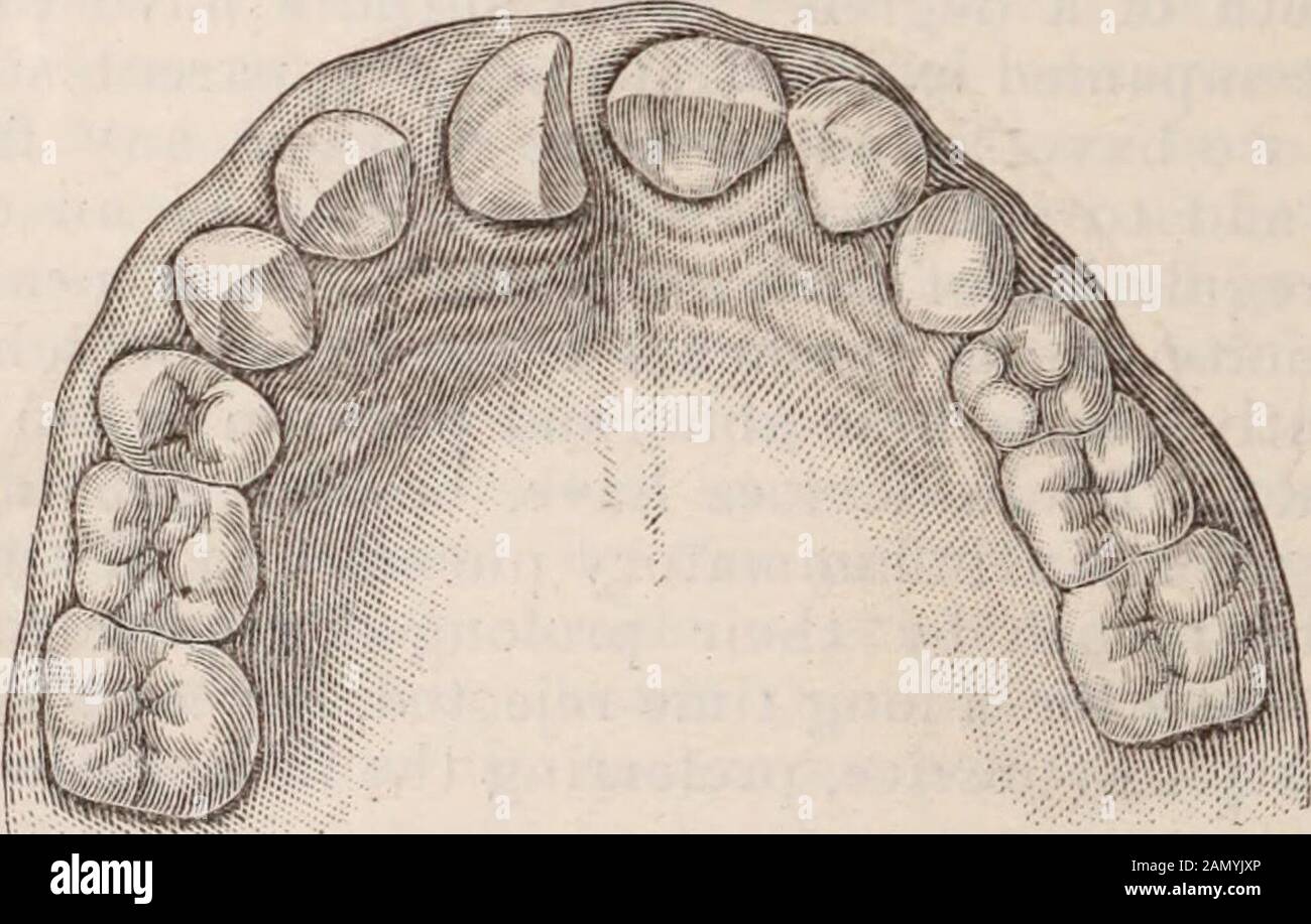 Only lateral position hi-res stock photography and images - Alamy