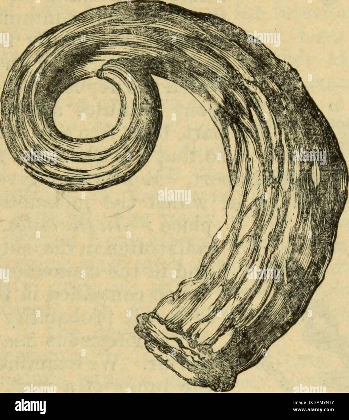 Manual of pathological anatomy . (a) Papillary prominence of epithelial ...