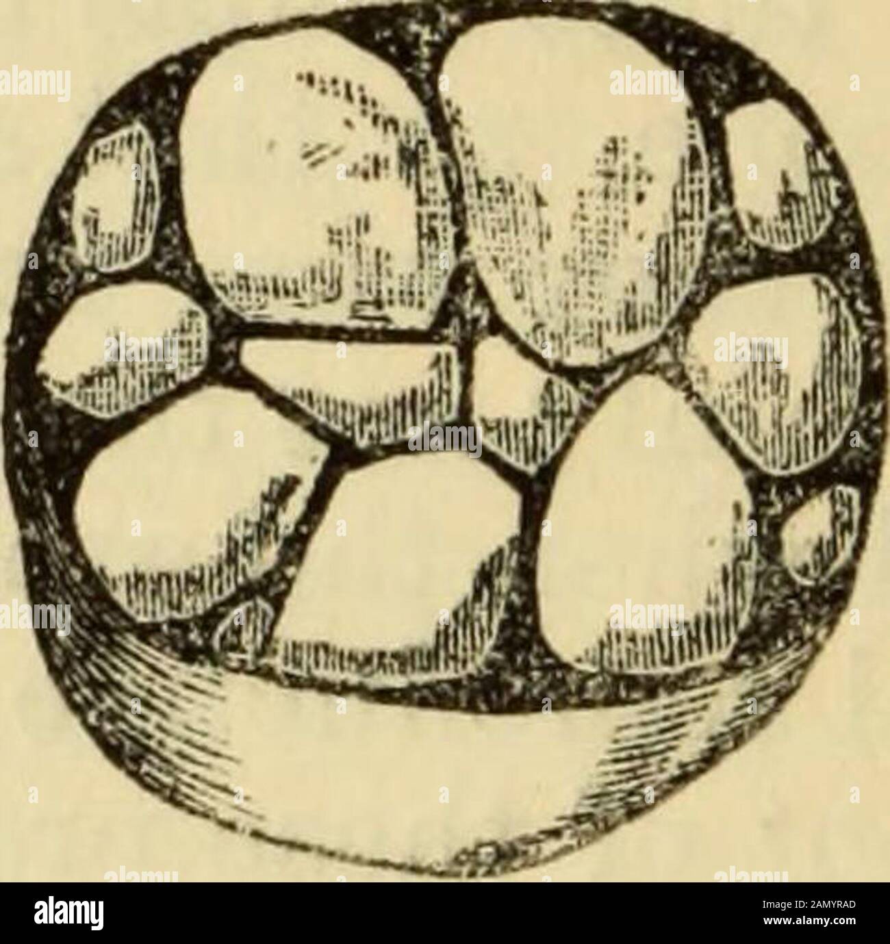Manual of pathological anatomy . Diagram of compound cysts. In the left ...
