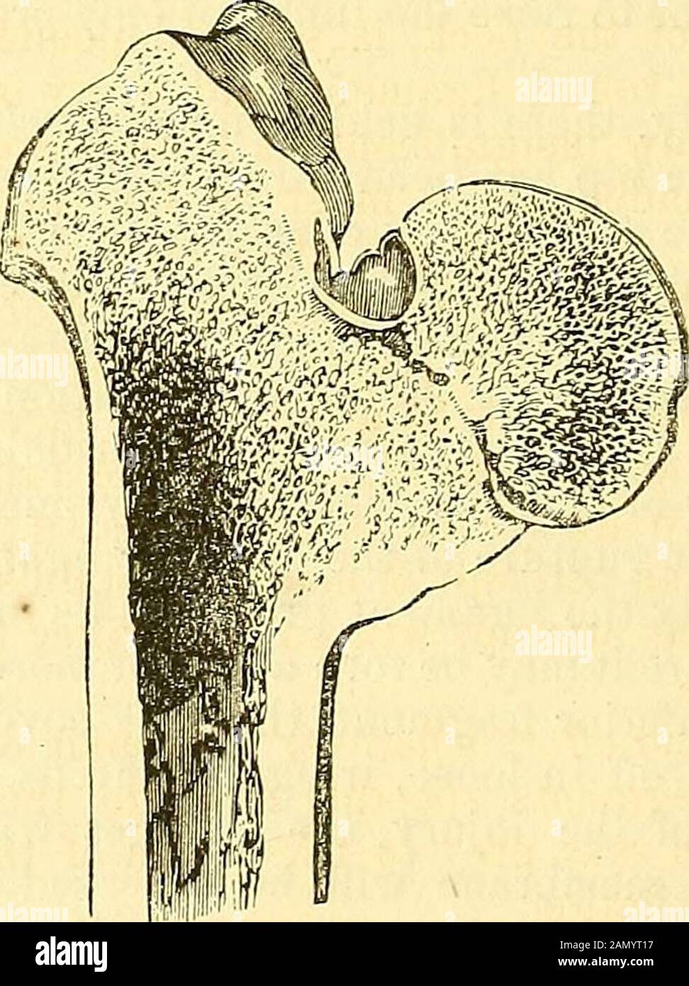 Olecranon process hi-res stock photography and images - Alamy