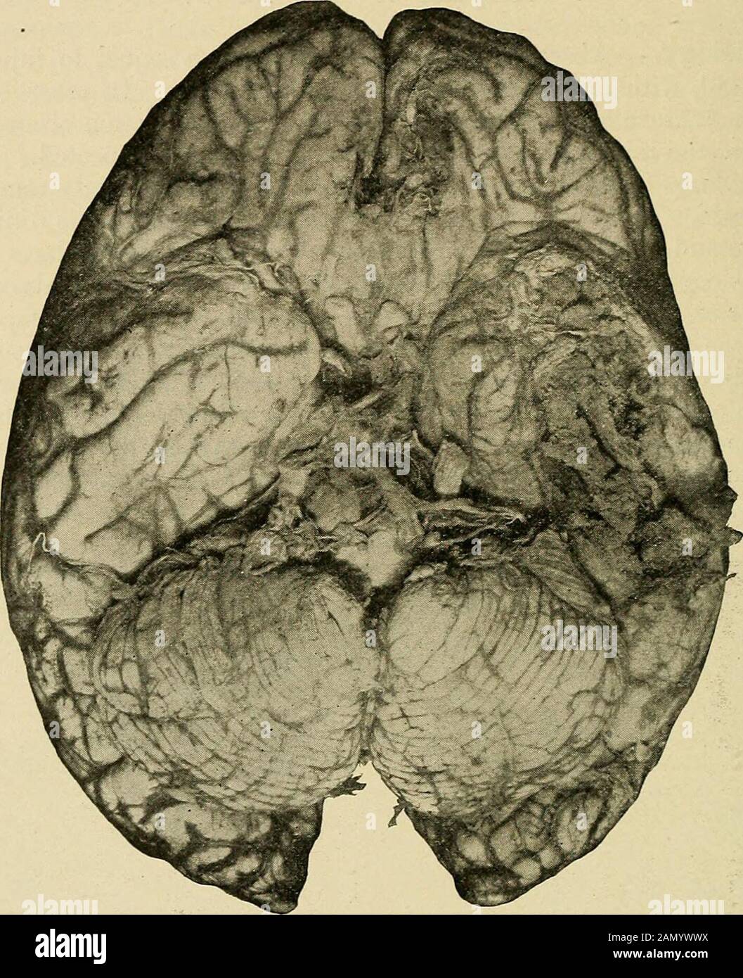 Organic and functional nervous diseases; a text-book of neurology ...