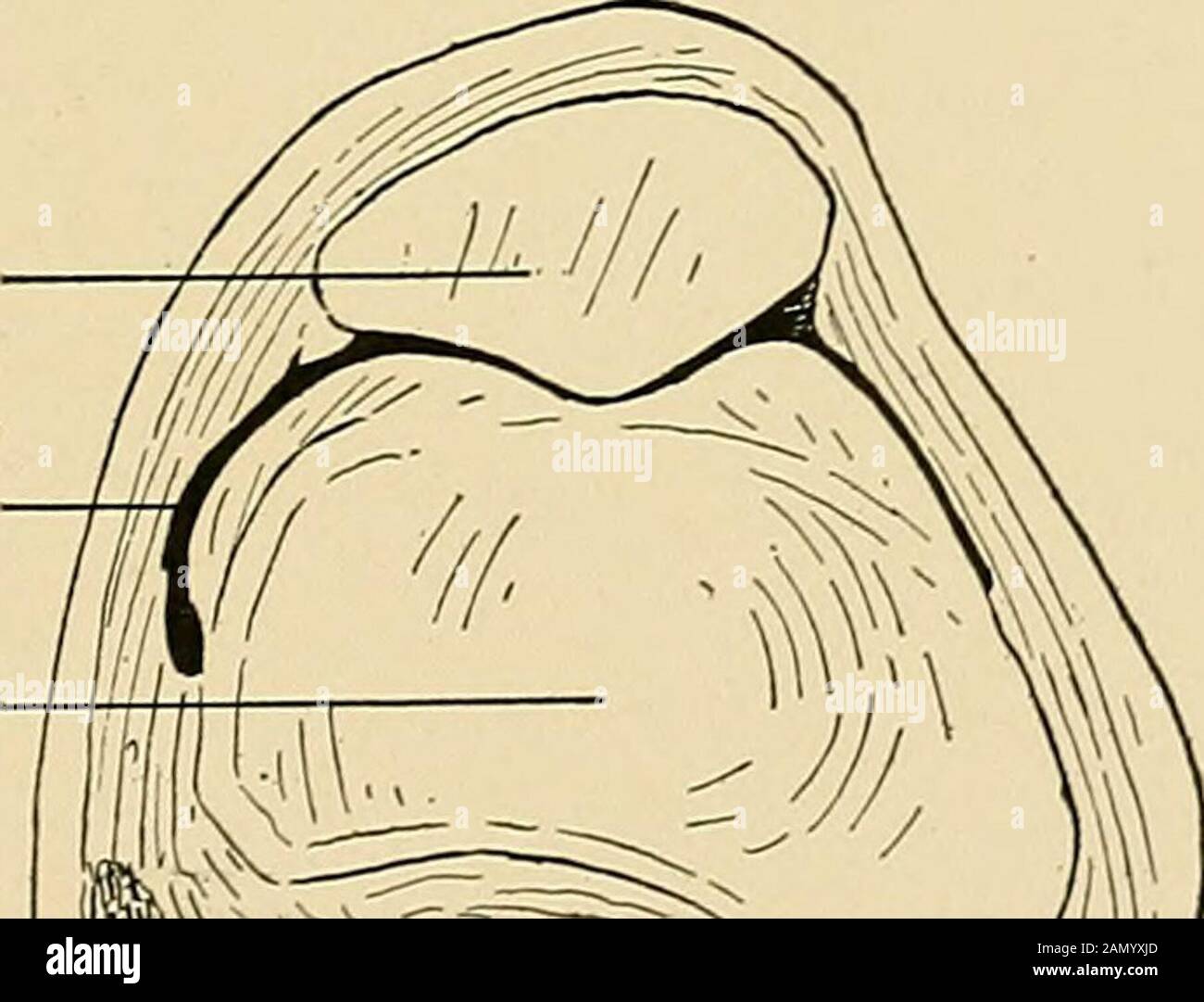 Synovial membrane hi-res stock photography and images - Alamy