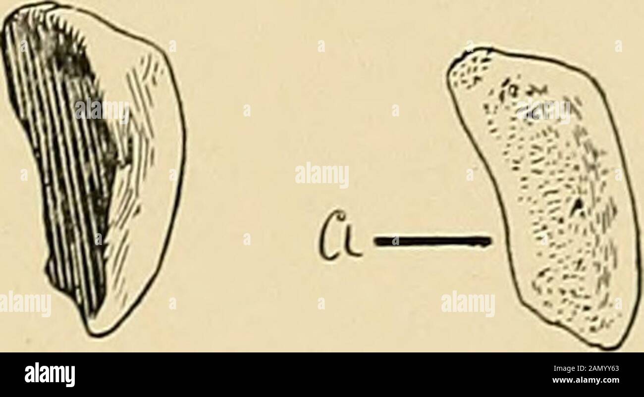 The treatment of fractures . —V Fig. 443.—Normal patella: i, From in ...
