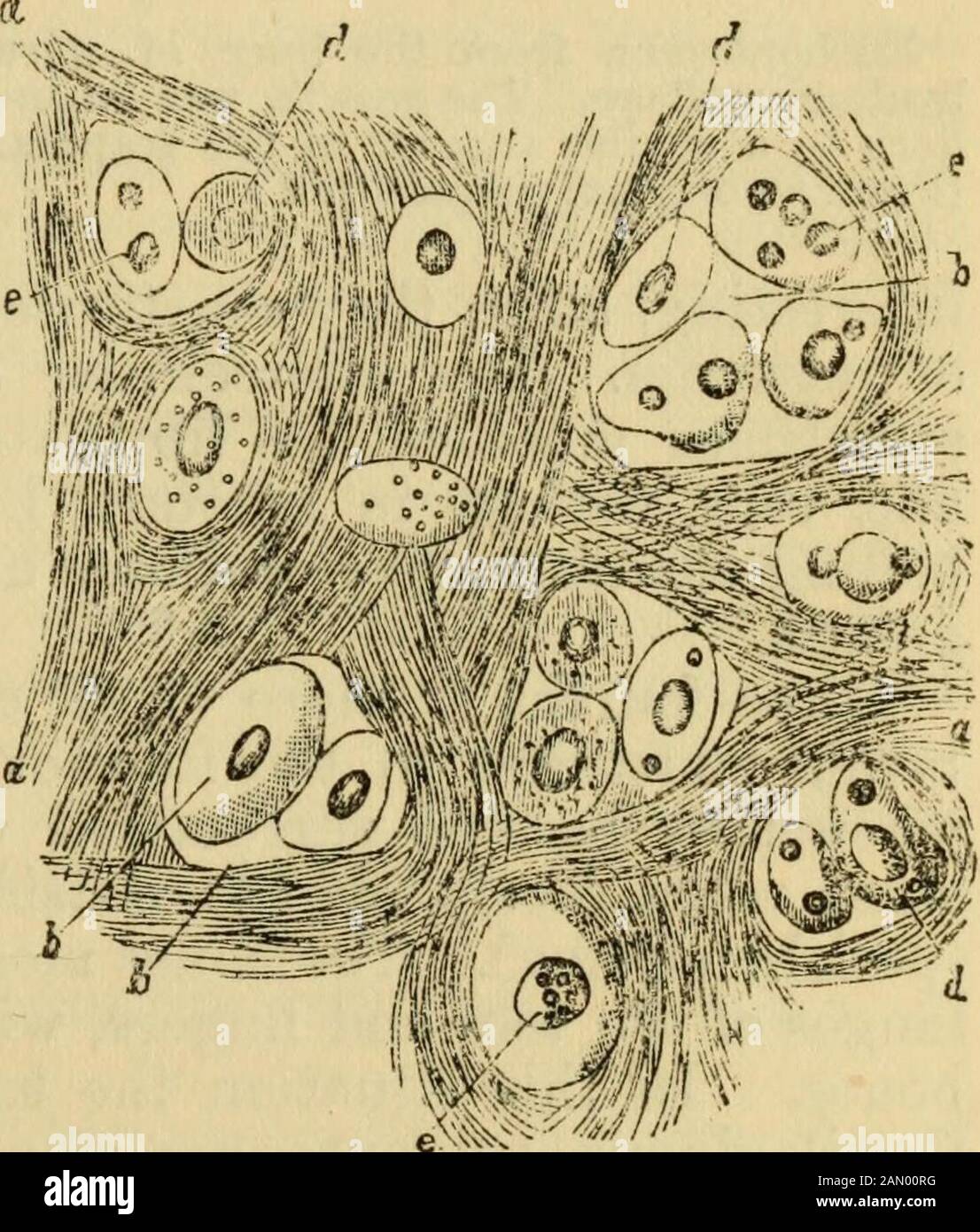 Enchondroma Histology