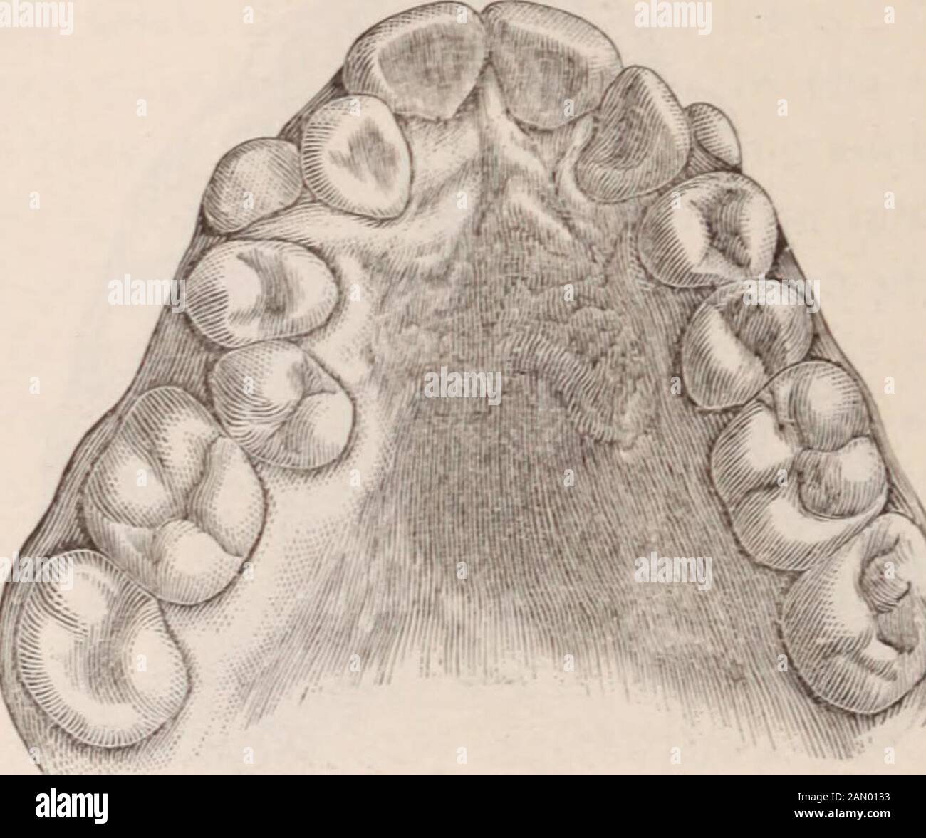 Order of appearance of teeth hi-res stock photography and images - Alamy