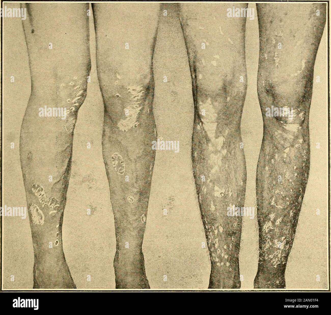 Modern diagnosis and treatment of diseases of childern; a treatise on ...