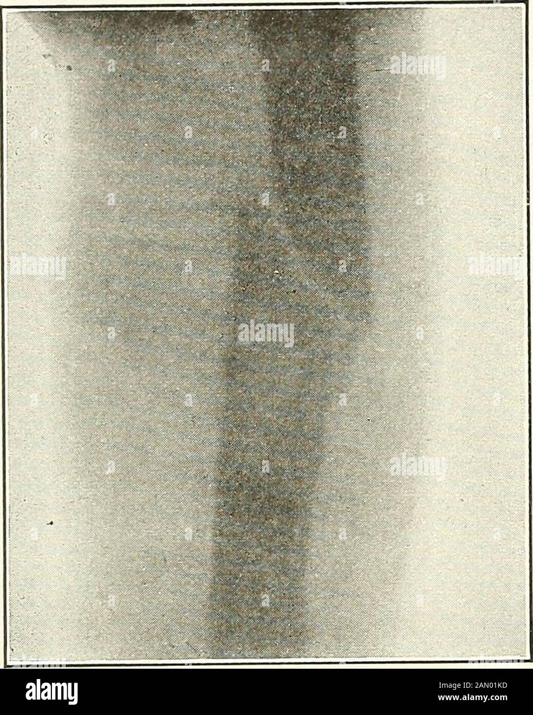Gunshot injuries : how they are inflicted : their complications and ...