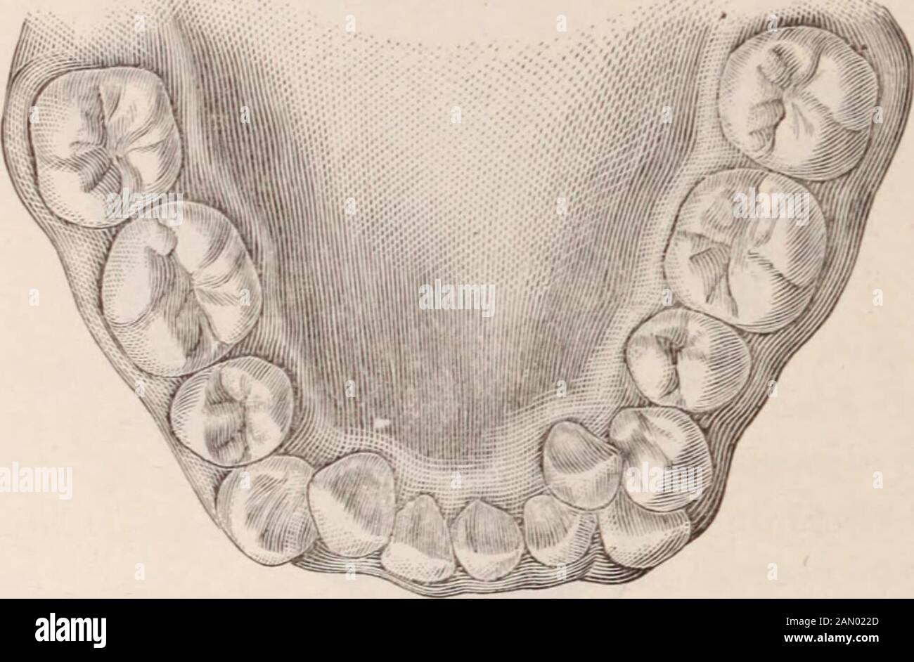 Dental cosmos . ardmovement of the posterior teeth, 102 THE DENTAL ...
