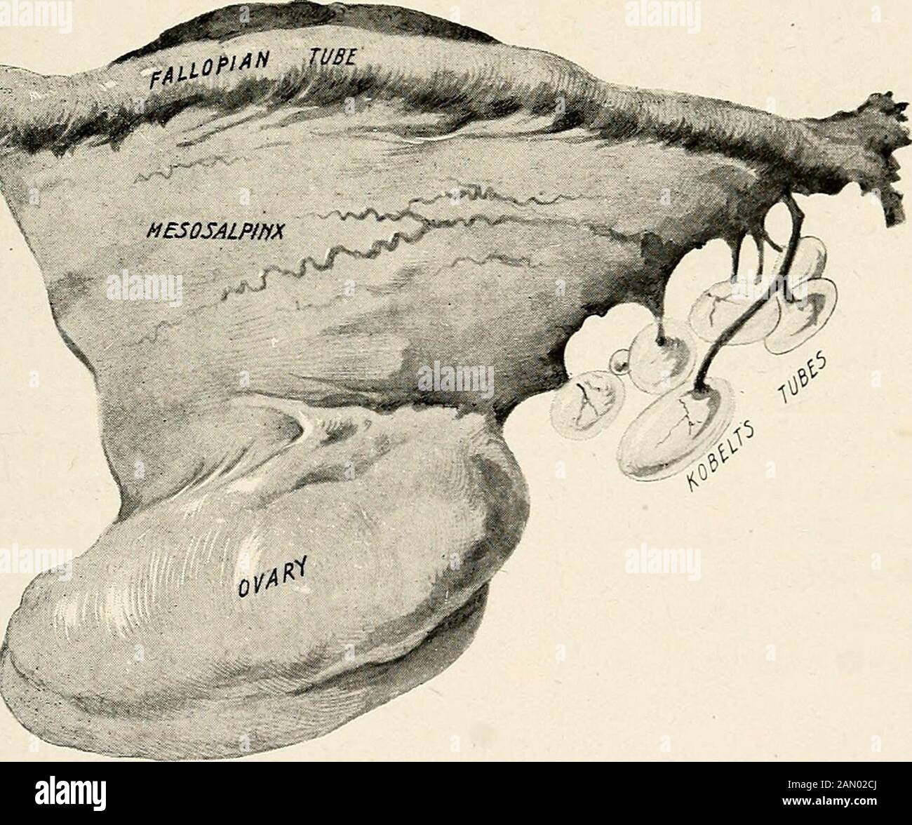 Ovarian cysts hi-res stock photography and images - Alamy