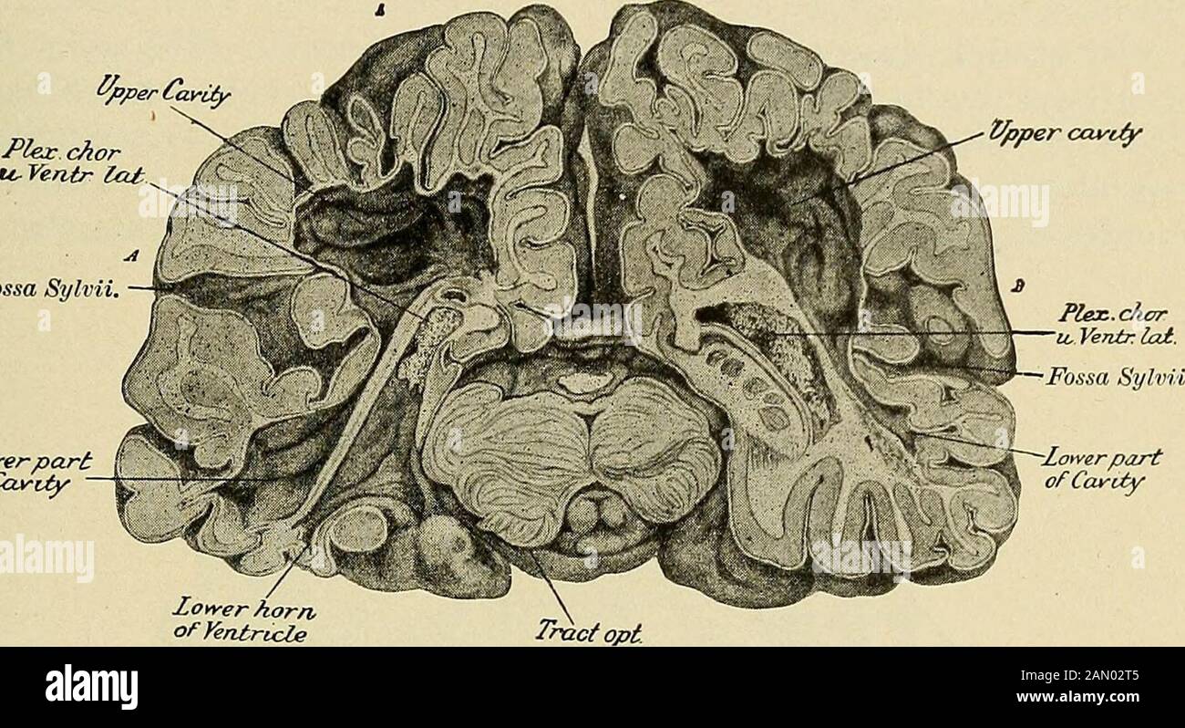 Hemi sphere hi-res stock photography and images - Alamy