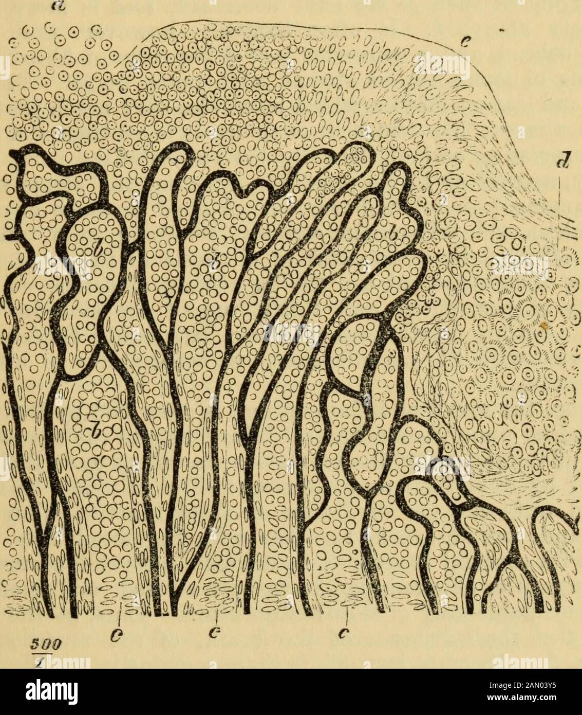 Pus cells hi-res stock photography and images - Alamy