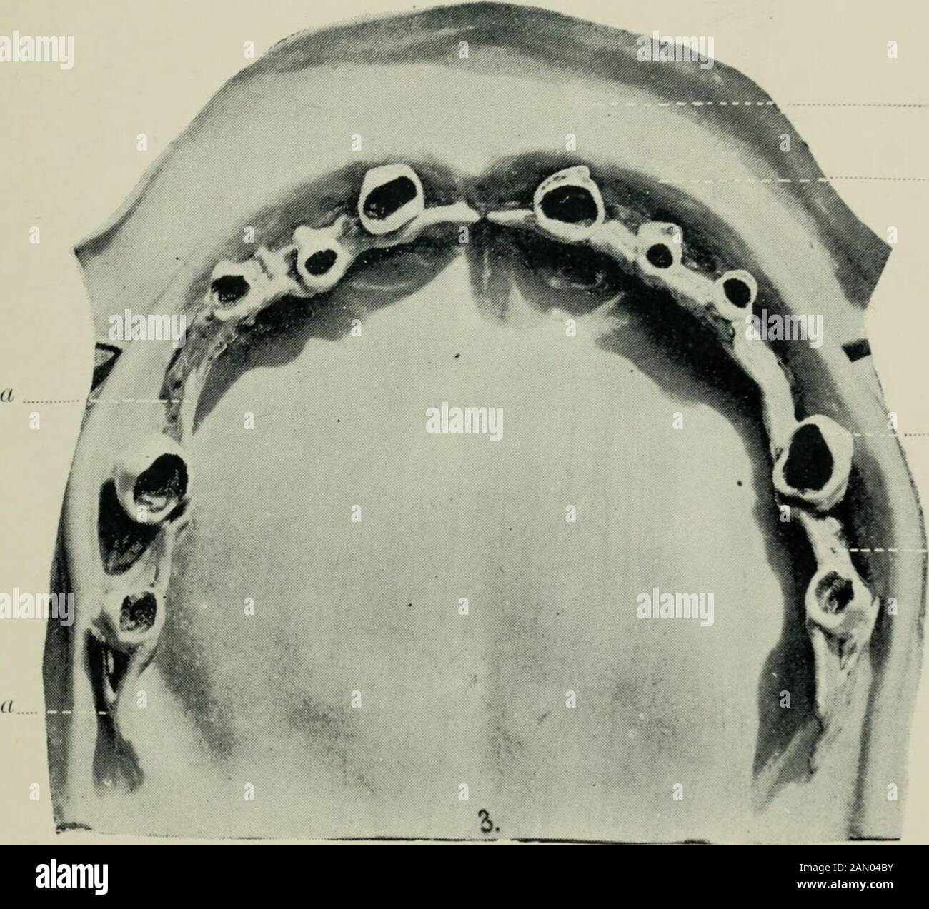 Transactions of the odontological society of Great Britain . Fig. 2 ...