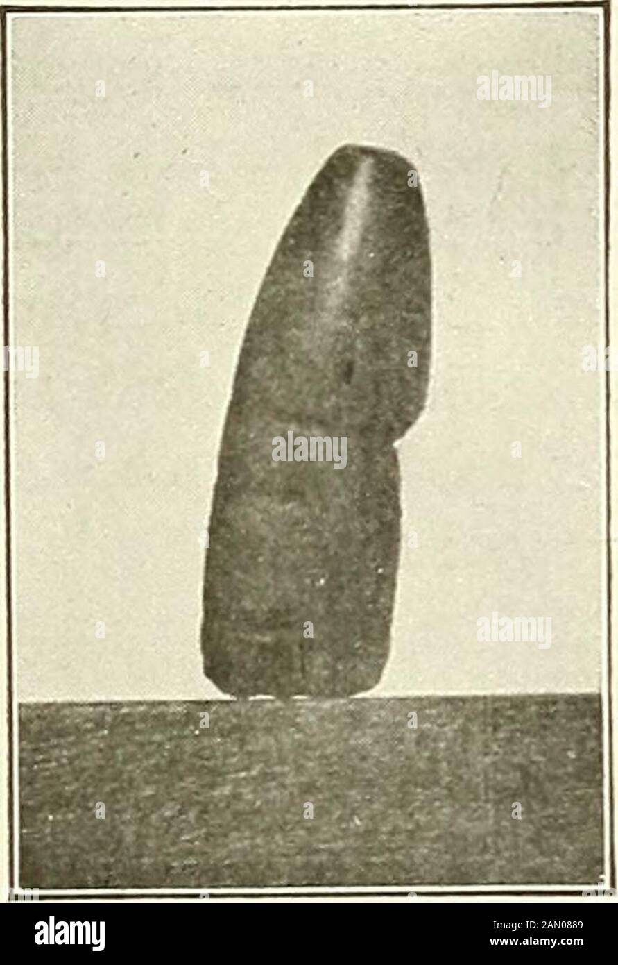 Gunshot injuries : how they are inflicted : their complications and ...