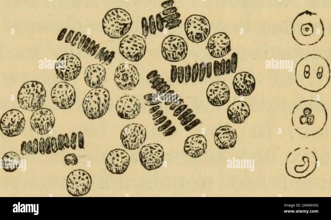 Grumous hi-res stock photography and images - Alamy