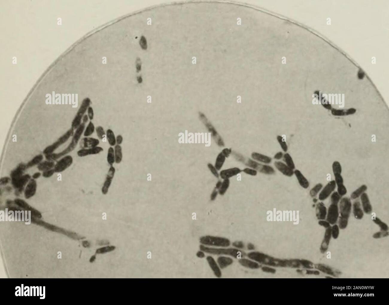 Septicus hi-res stock photography and images - Alamy