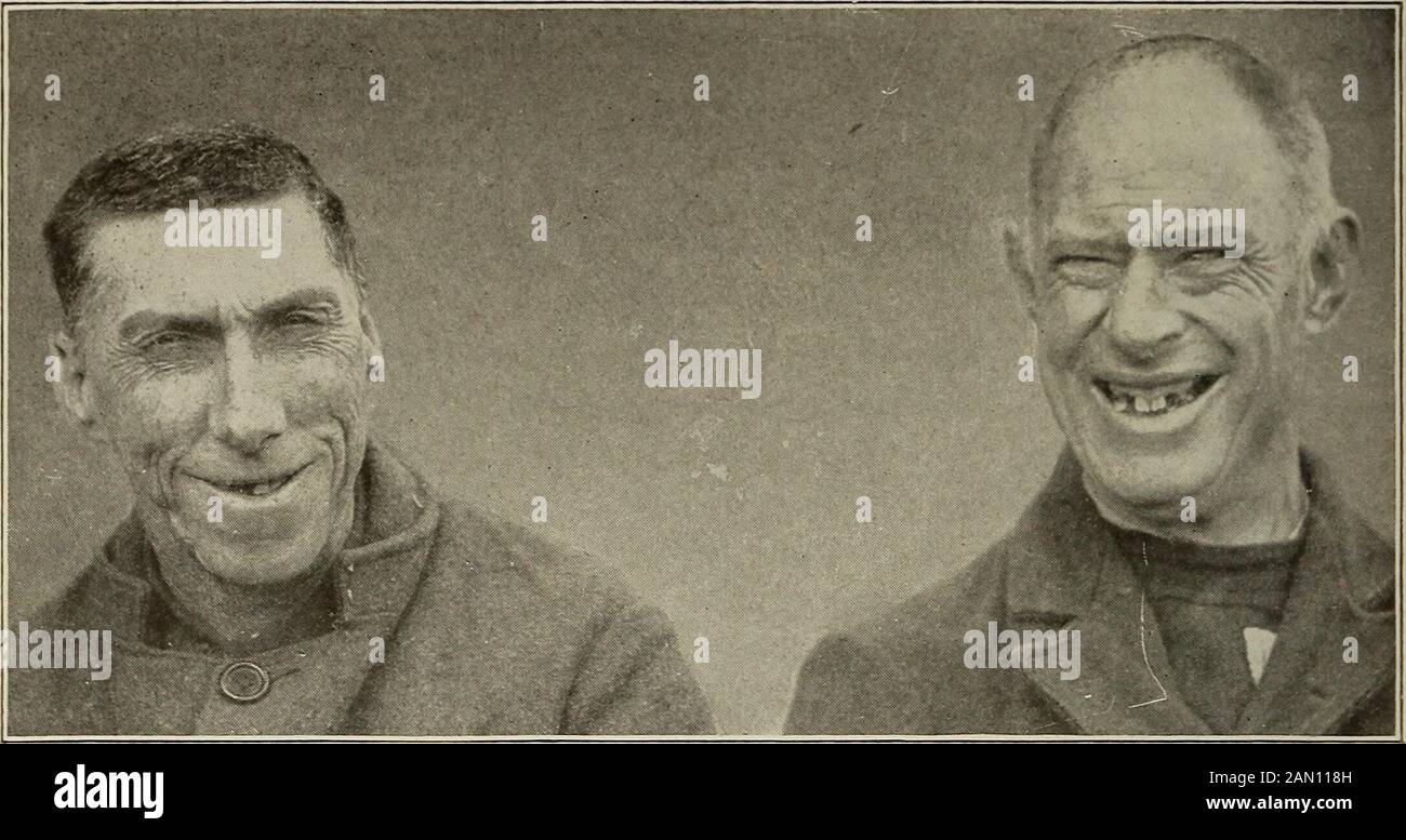 Microcephalic Pinheads