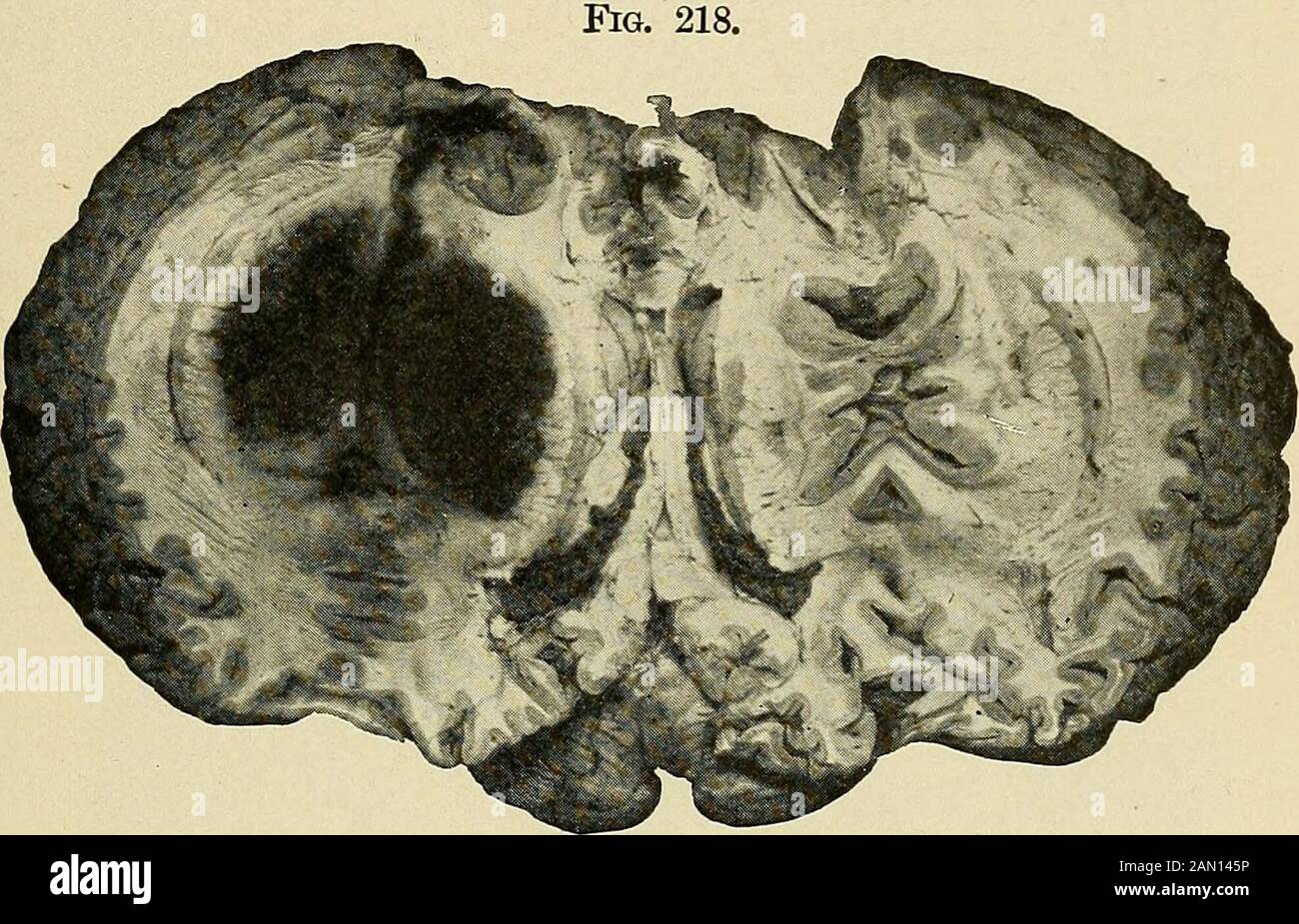 Rup text hi-res stock photography and images - Alamy