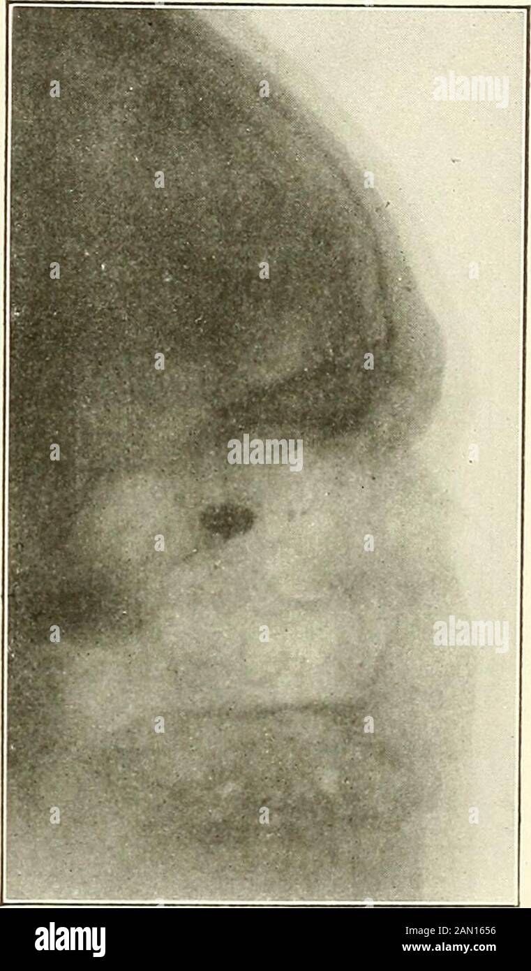 Injured right eye hi-res stock photography and images - Alamy