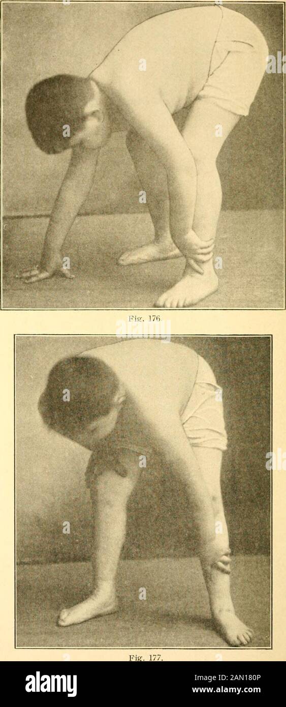 Modern diagnosis and treatment of diseases of childern; a treatise on ...