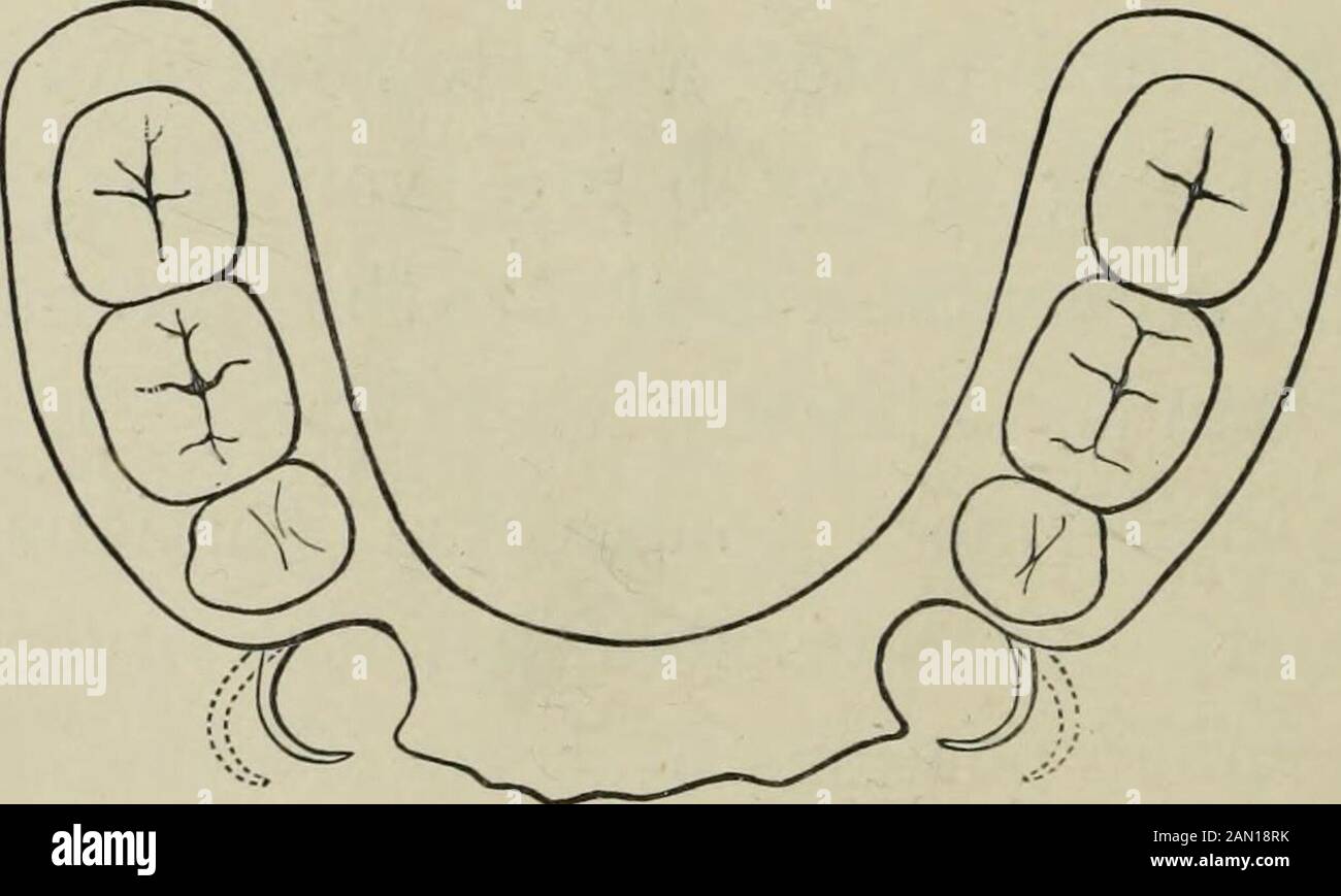 Two long iron bands hi-res stock photography and images - Alamy