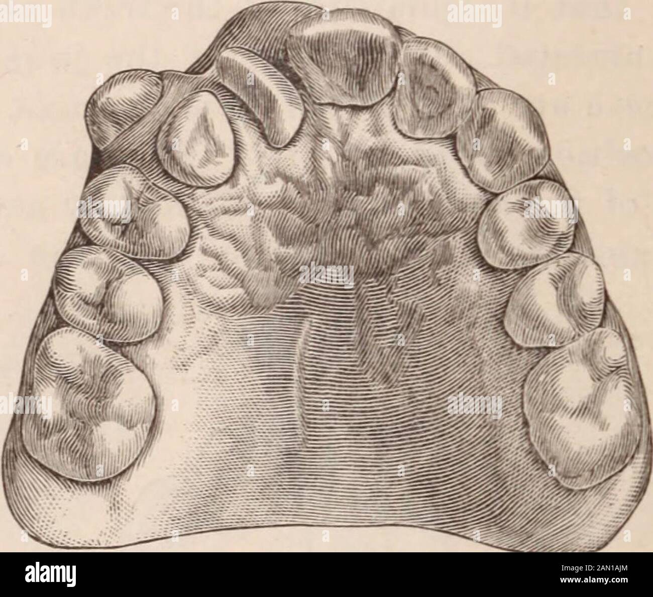Dental cosmos . the laterals passed posterior to the distal points ...