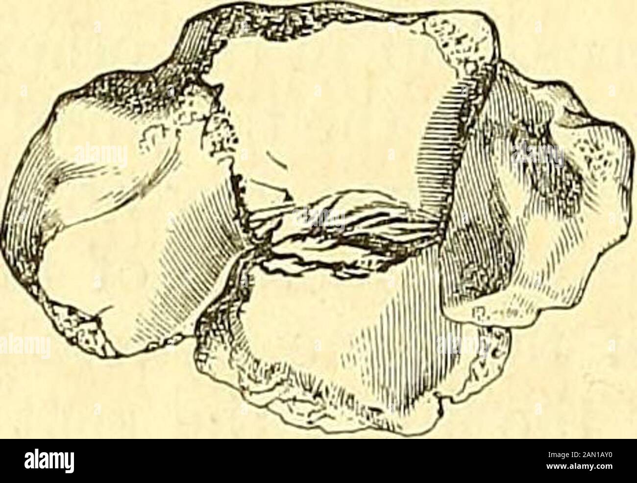 A system of surgery : pathological, diagnostic, therapeutic, and ...