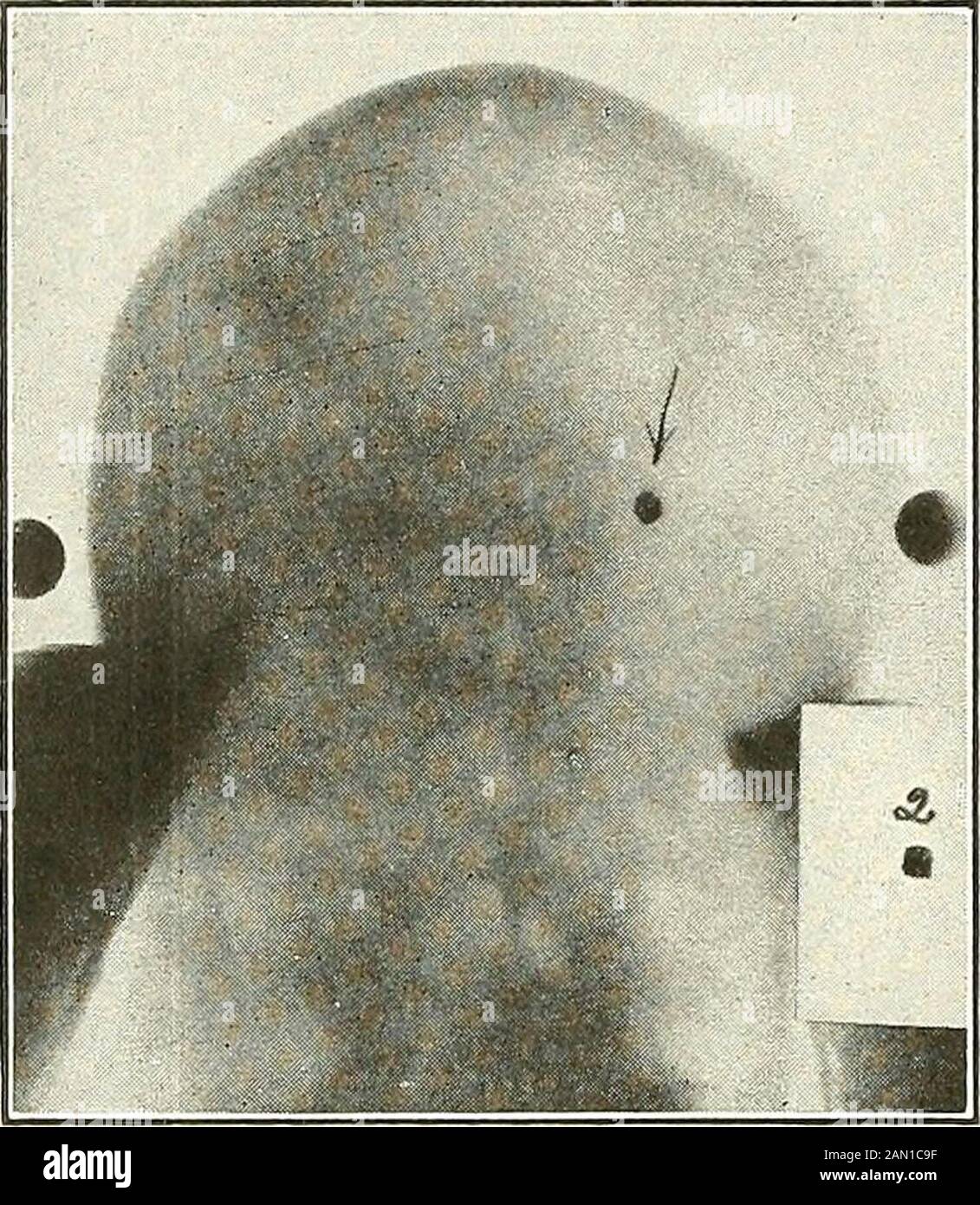 Battlefield injuries hi-res stock photography and images - Alamy