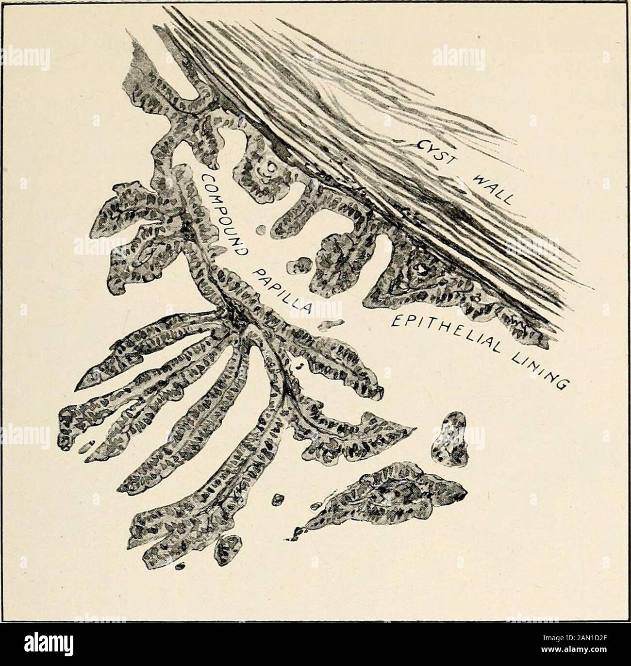 Stringy connective tissue hi-res stock photography and images - Alamy