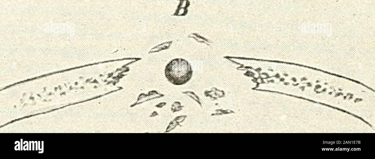 Gunshot injuries : how they are inflicted : their complications and ...