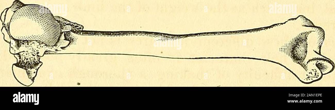 Anatomical neck of humerus hi-res stock photography and images - Alamy