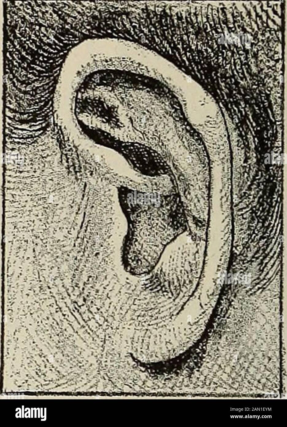 Nervous and mental diseases . Fiff. 296.—Triplication of crura furcata ...